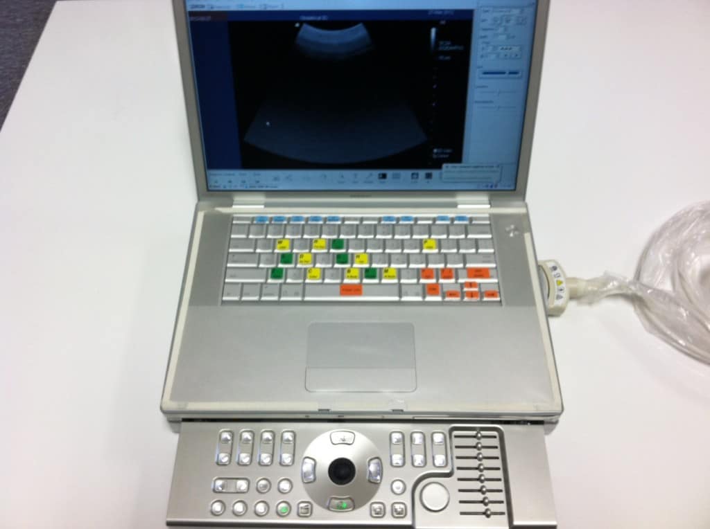 TERASON T3000 COLOR PORTABLE ULTRASOUND SYSTEM - Choice Medical Systems ...